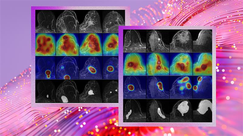 Revolutionary Ways Microsoft’s AI-Powered Breast Cancer Screening ...